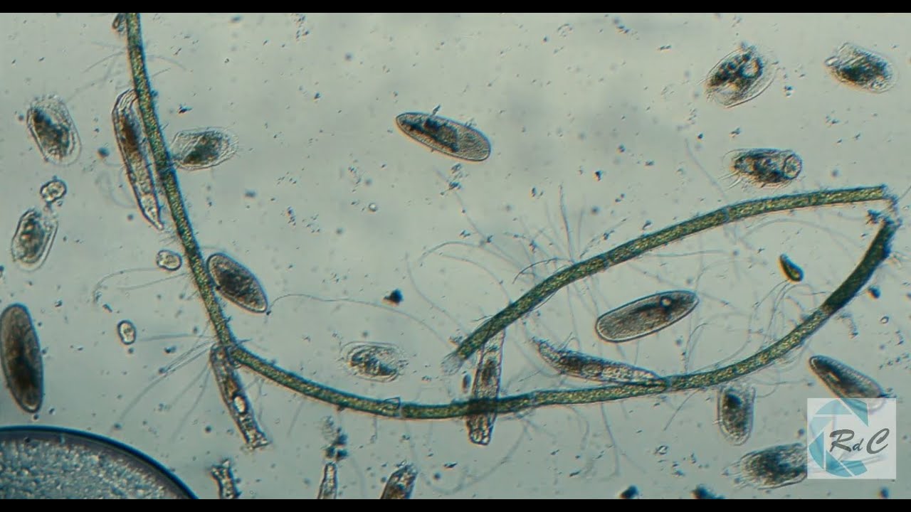 Protozoarios Sob Microscopio Optico Una Visión Cercana De La